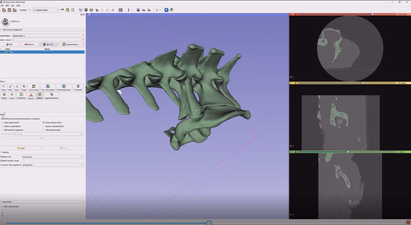CT data to 3D print in 15 minutes using free software – Prof. Peter L ...